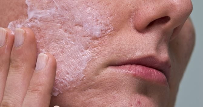 Zeg Dag Tegen Acne Littekens met Argan Olie