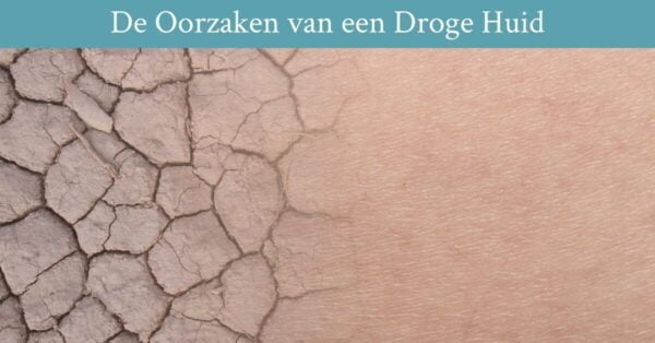 Een Droge huid, Oorzaken, Verzorging en Handige Tips!